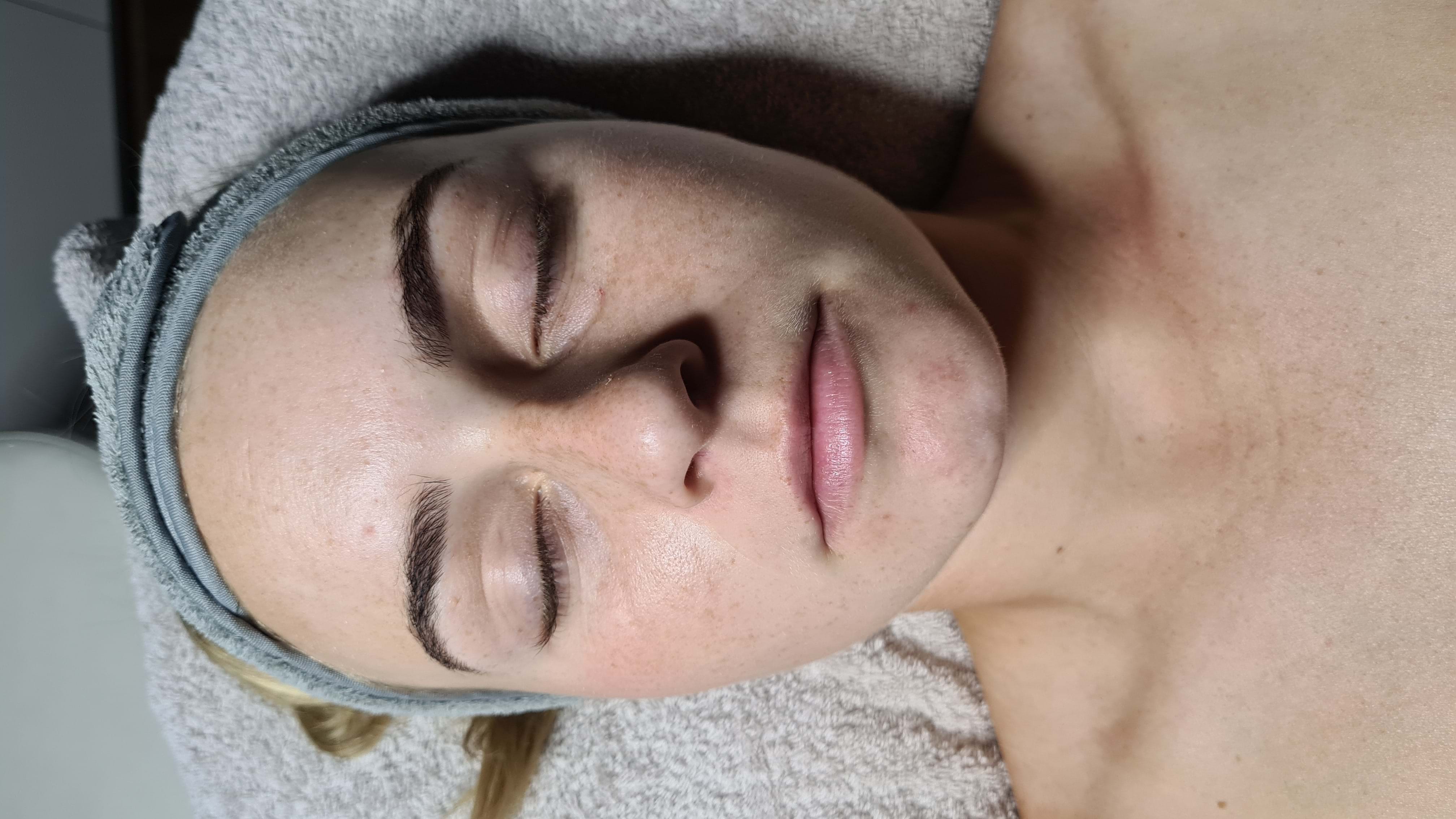 Sensitive Delicate Facials