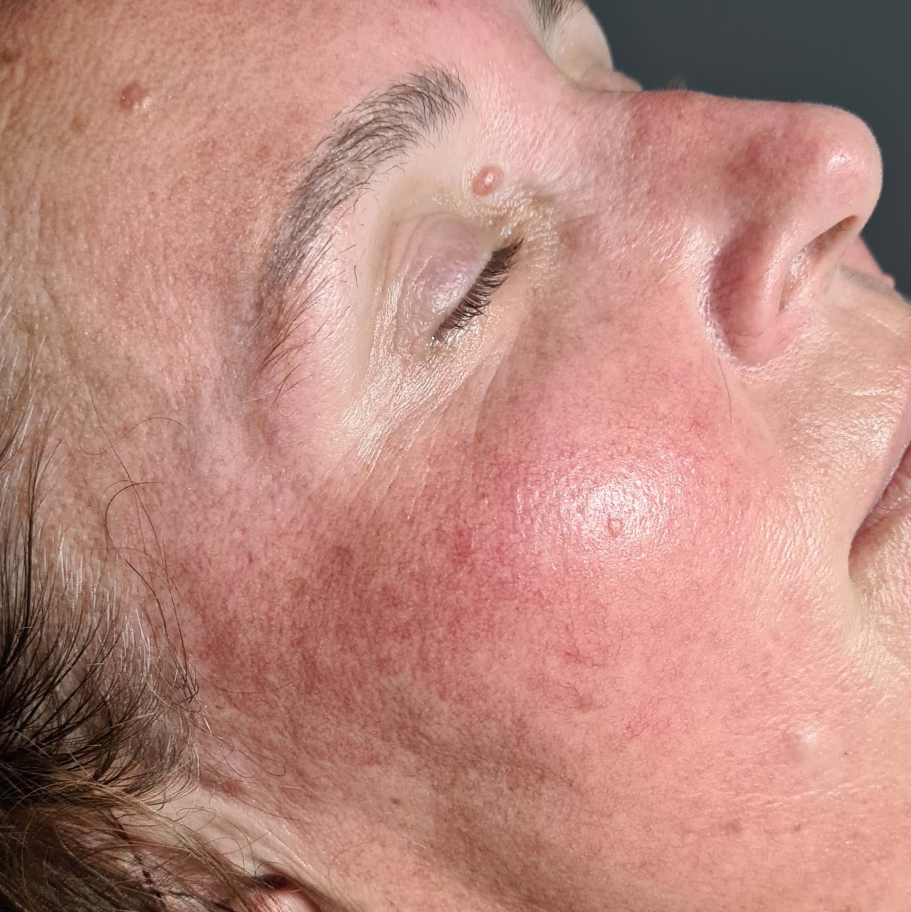 Sensitive Delicate Facials