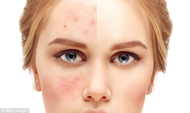Sensitive Skin vs Sensitised Skin
